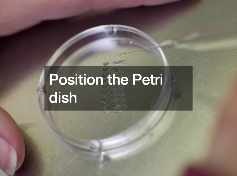 How Do You Count Colonies? Colony Counting for Beginners - Letters and ...